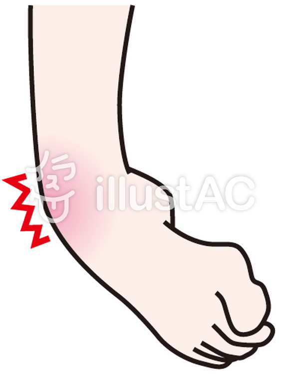 捻挫イラスト - No: 1393390／無料イラストなら「イラストAC」