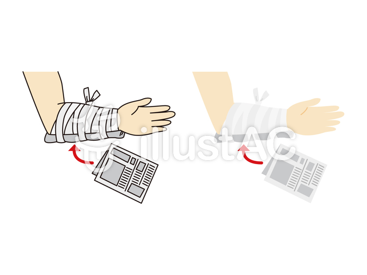 新聞を使った応急手当イラスト - No: 1029216／無料イラストなら「イラストAC」